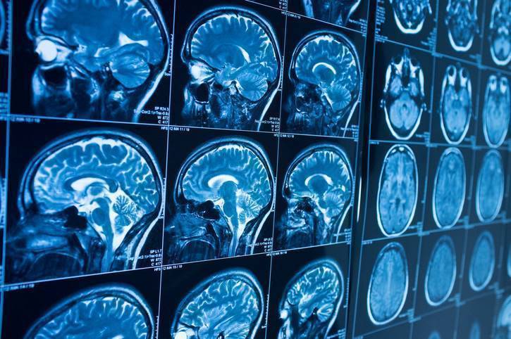 Sydney Uni's Brain and Mind Centre scores $7m for AI projects - iTnews