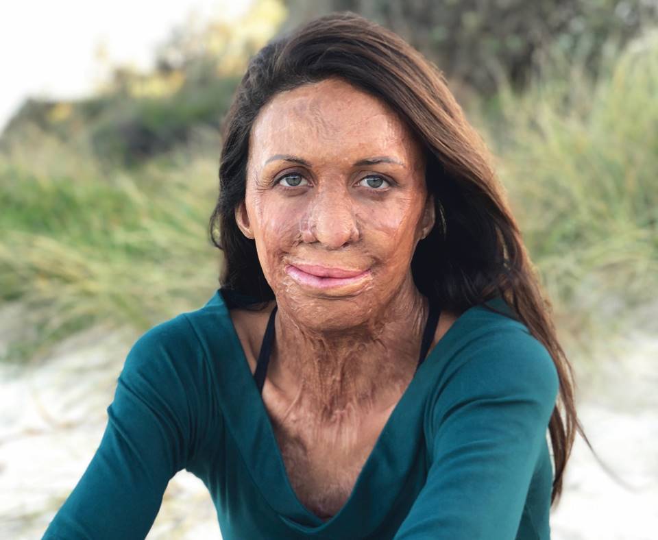 10 life lessons from Turia Pitt - Mind - Prevention Australia