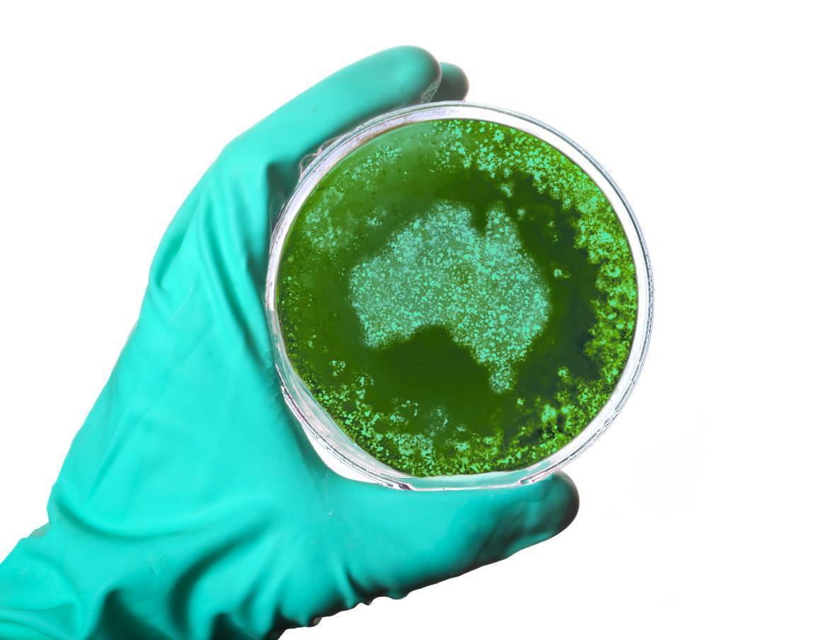 Australia to get an AI-powered map of drug-resistant germs - iTnews