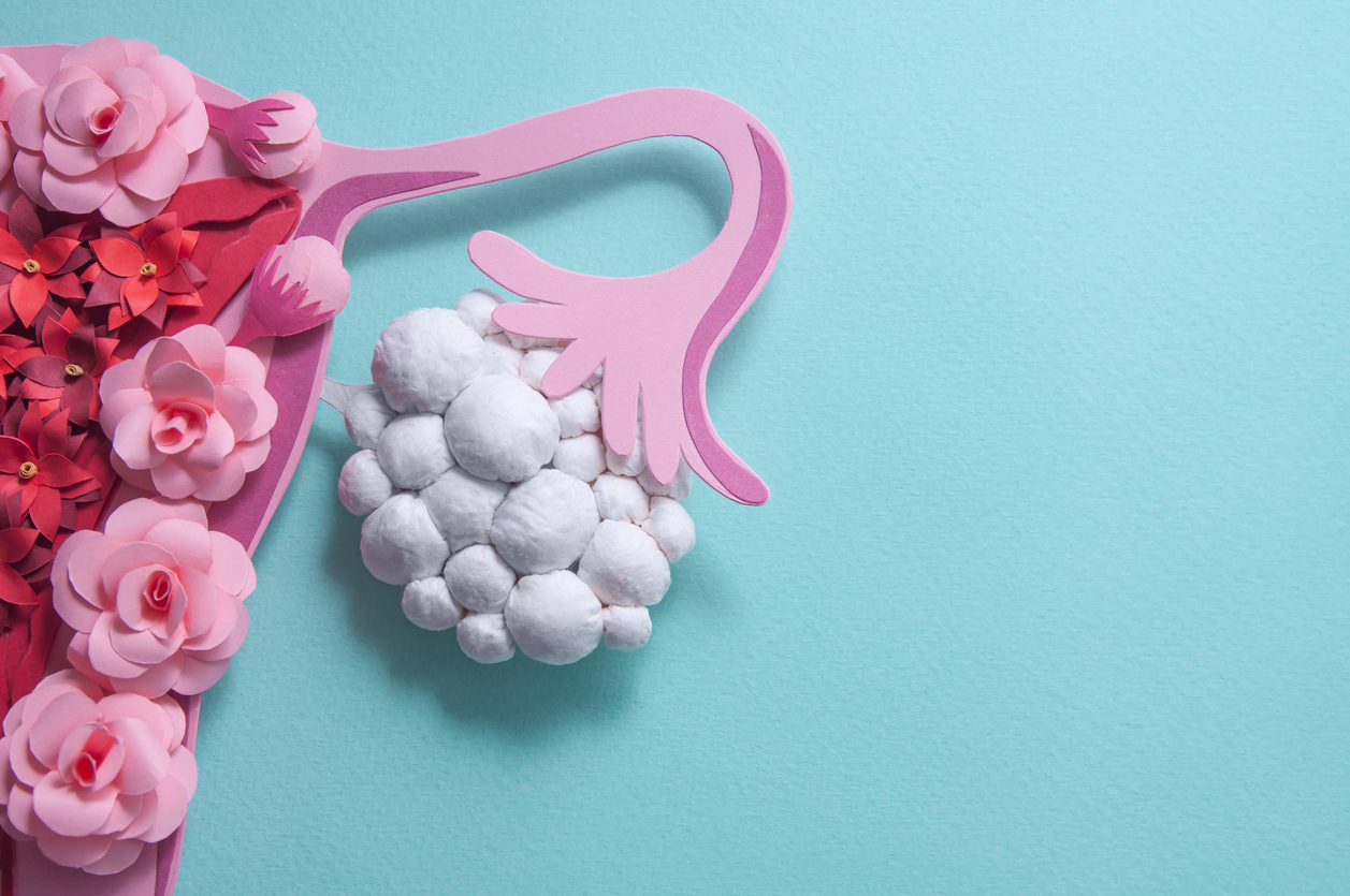 PCOS Is Now PMOS: What the Name Change Means