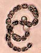 Kernel-level malware on the rise - iTnews